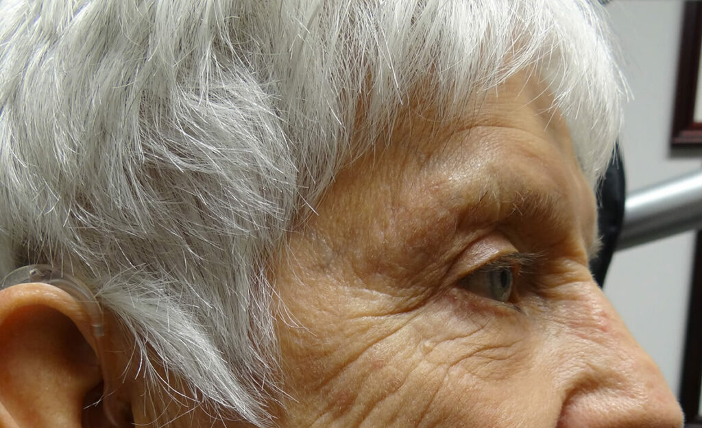 Eyelid Surgery and Cosmetic Injection Gallery | Aesthetic Institute